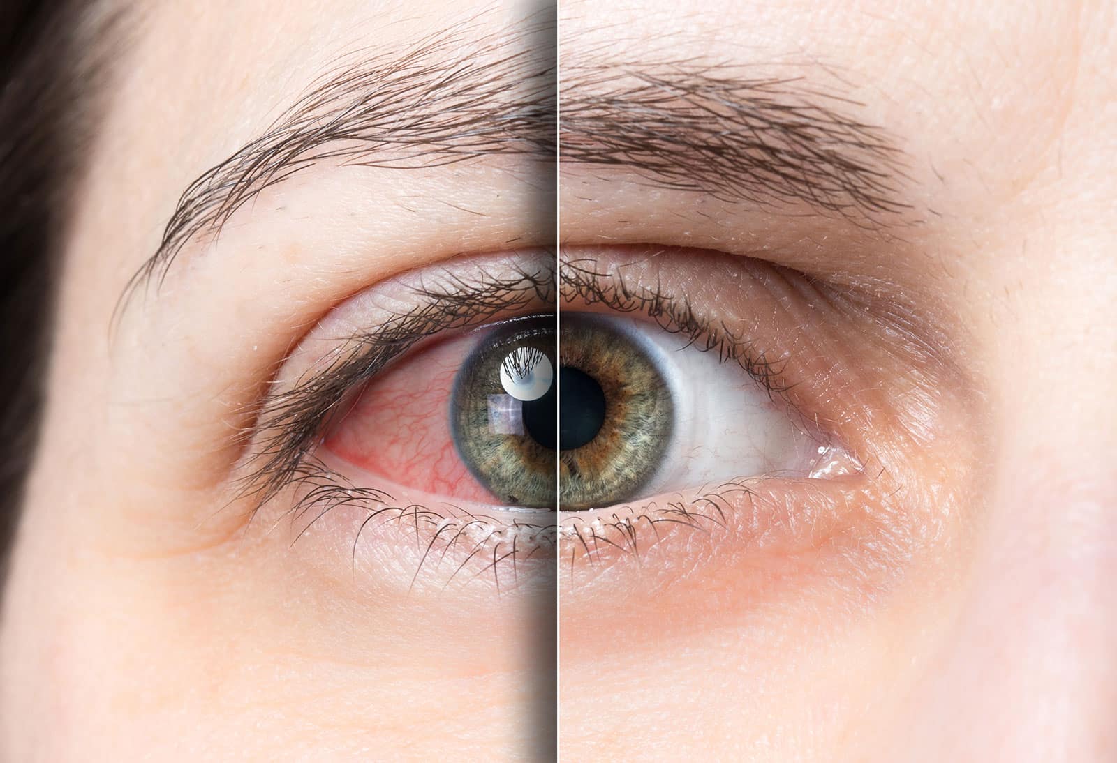 Eyes on Shrooms: Pupil Effects, Visual Changes & Comparison With Other ...