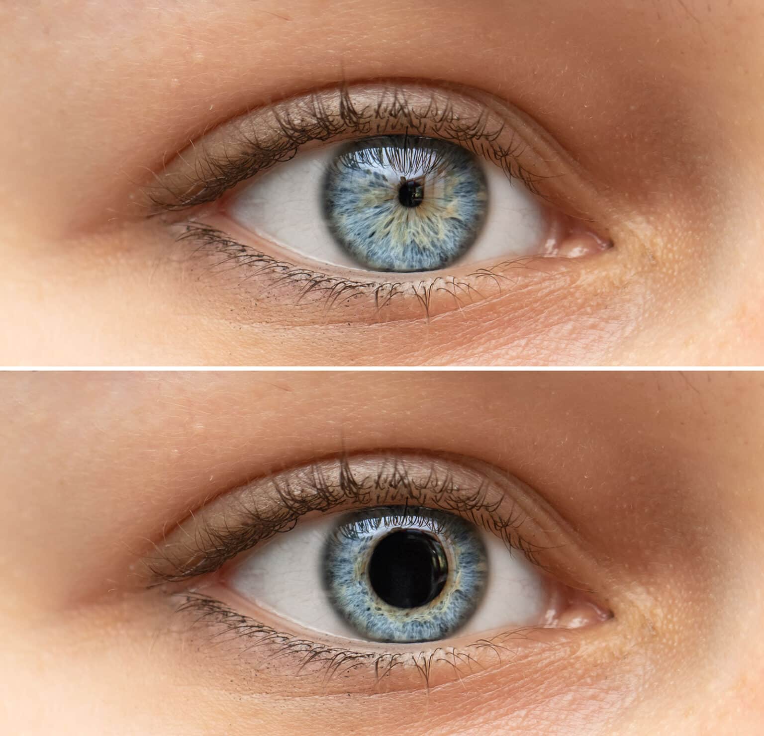 Eyes on Shrooms: Pupil Effects, Visual Changes & Comparison With Other ...